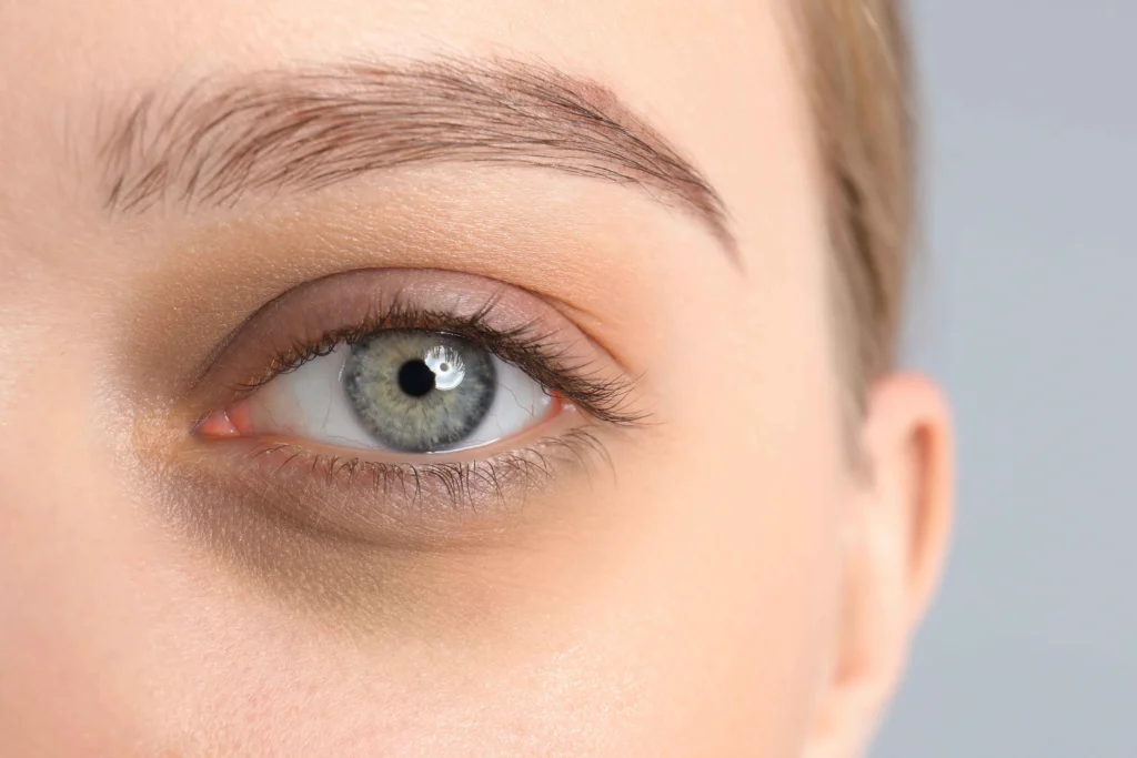 PRP/PRF Tear Trough Treatment: What To Know